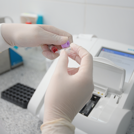 QUIMICA SANGUINEA – Laboratorio Endogenética Santa Cruz – LES